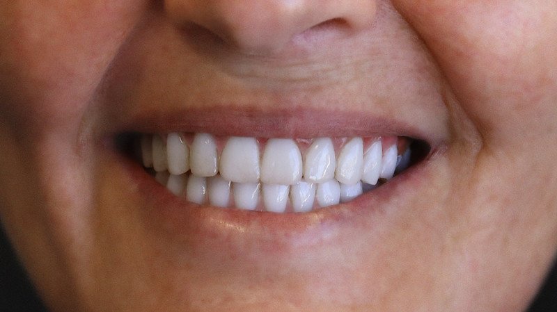 Desktop Health Einstein | CADvision